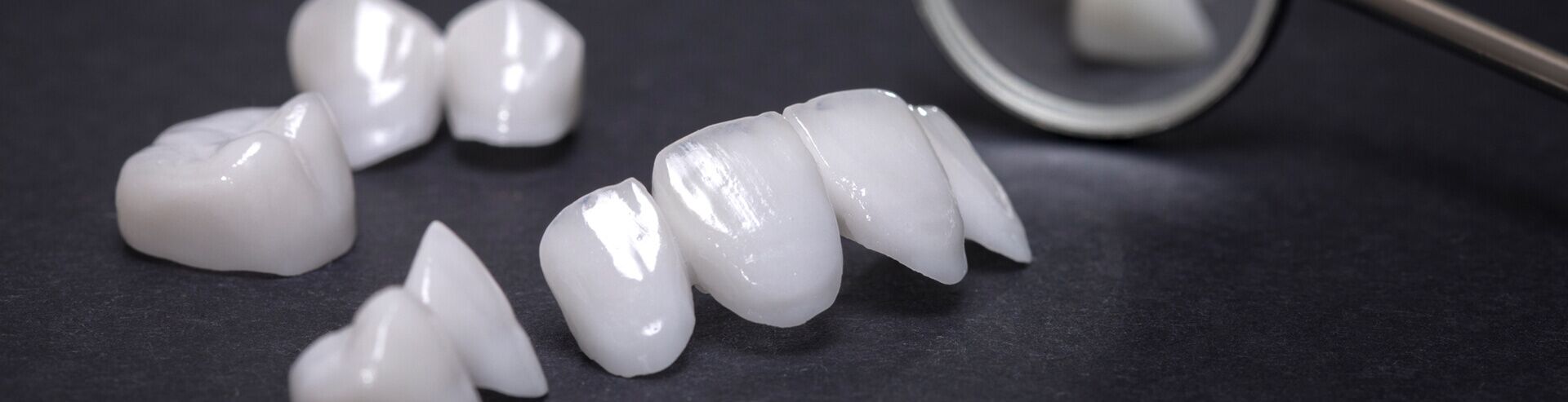 Dental Crowns & Onlays | LifeSmiles Dental Practice, Thatcham